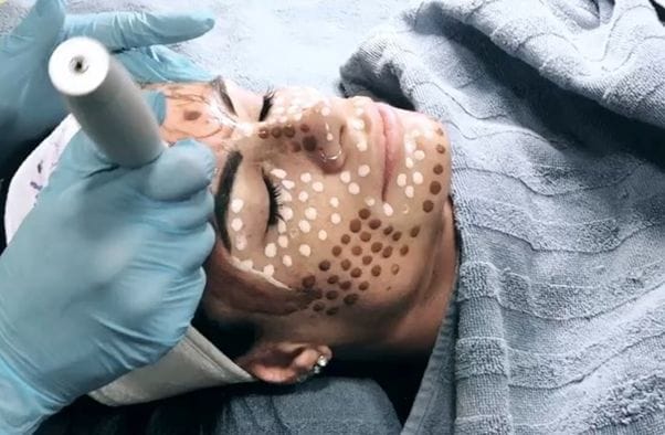 BB Glow Hamilton | Joie Day Spa